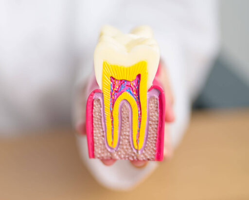 Todo sobre los dientes - Dental Solutions